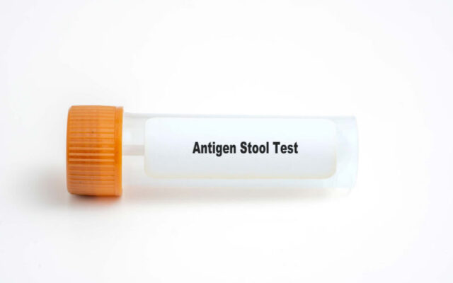 Fecal Test for Dogs: What It Is, Costs, and More