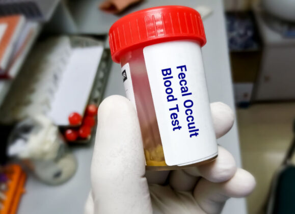 Fecal Test for Dogs: What It Is, Costs, and More